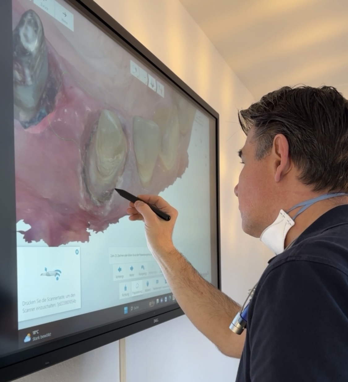 Intraoralscan - Zahnarztpraxis Kilic - OHZ - Ritterhude